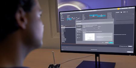 ScanWise Implant | Philips