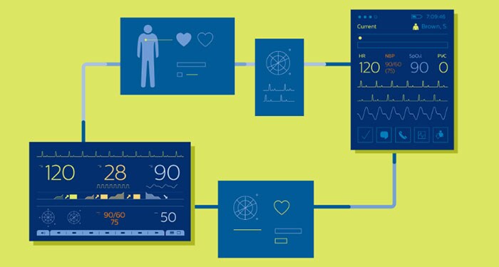 Patient monitoring systems | Philips Healthcare