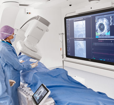 Image-guided therapy | Philips Healthcare