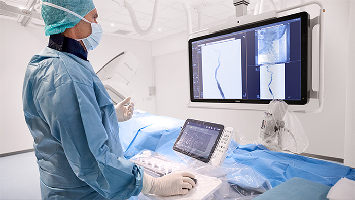 Ischemic stroke treatment | Philips