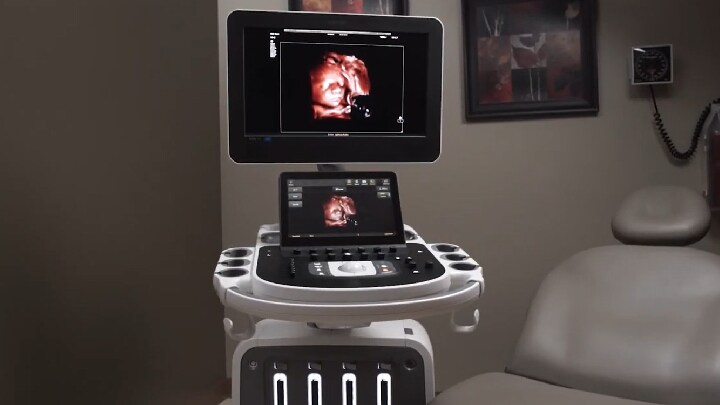 Women's Health Care Ultrasound Machines | Philips