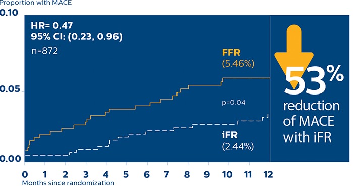 iFR and FFR help to guide PCI | Philips Healthcare