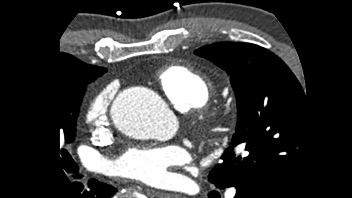CT Smart Workflow | Philips