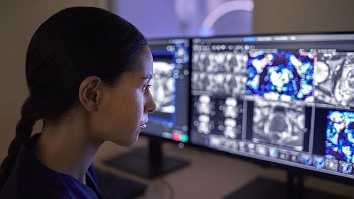Image-guided therapy | Philips Healthcare